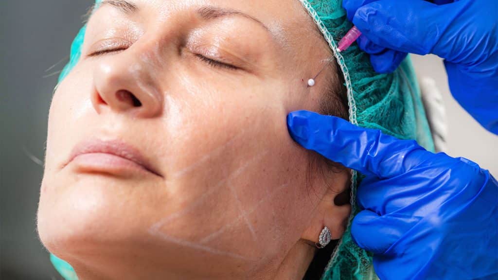 Sagging Face and Gravity Effect - Uzm. Dr. Seher Arı
